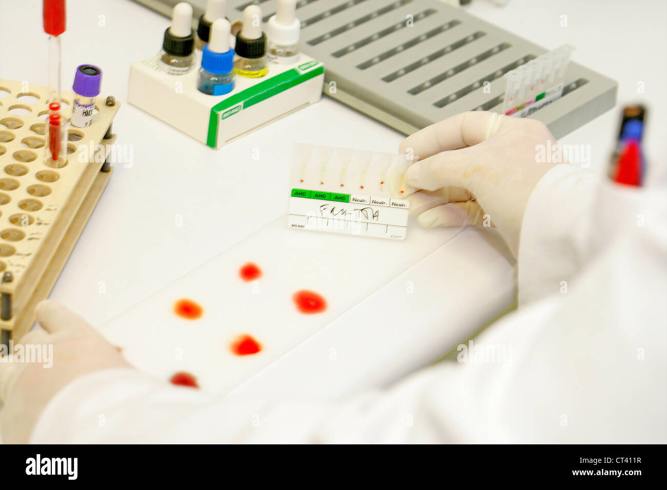 Abo blood type testing hi-res stock photography and images - Alamy