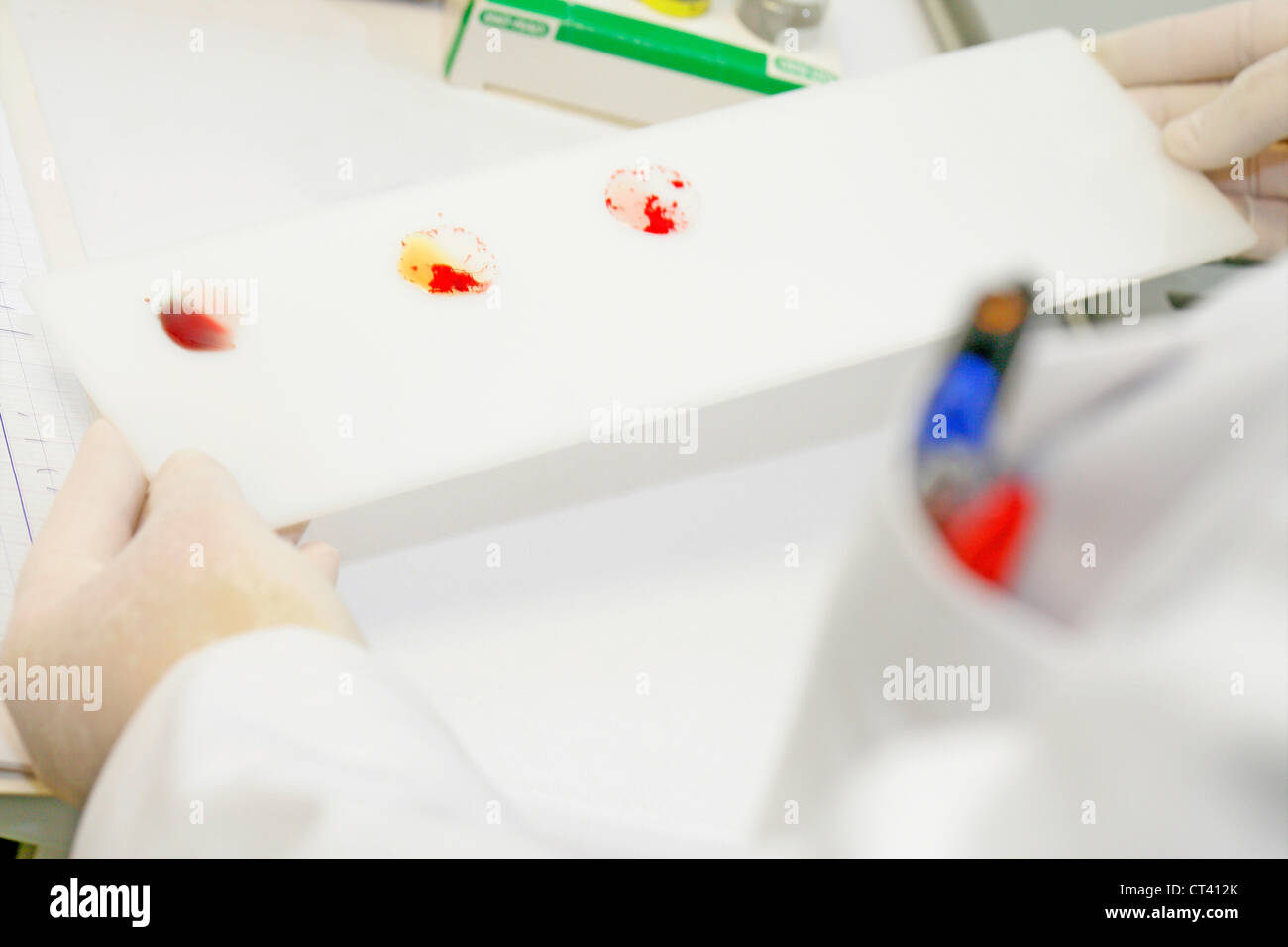 Abo blood type testing hi-res stock photography and images - Alamy