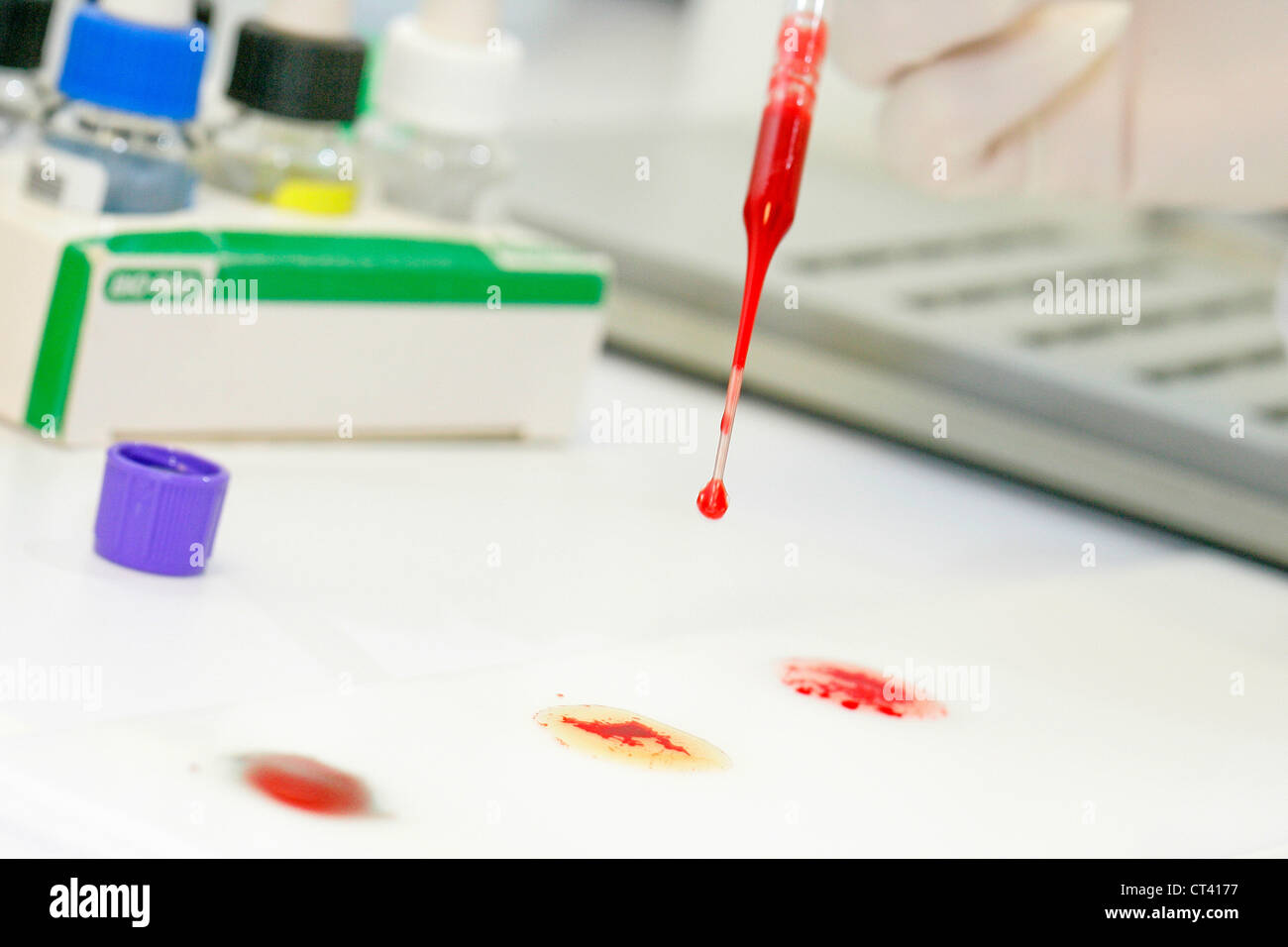 Abo Blood Type Testing High Resolution Stock Photography and Images - Alamy