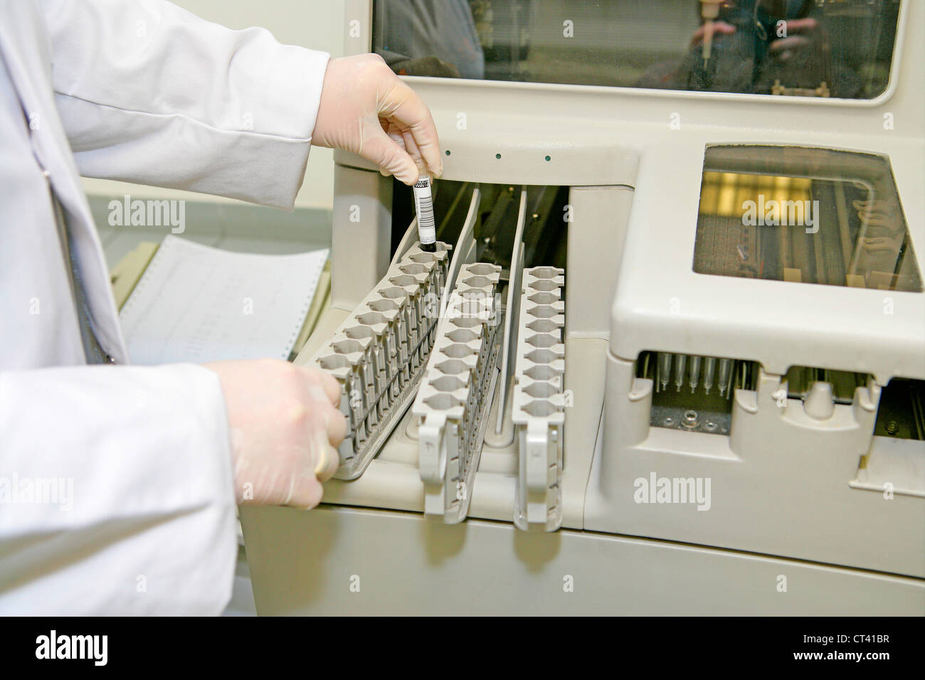 Blood chemistry analyzer hi-res stock photography and images - Alamy