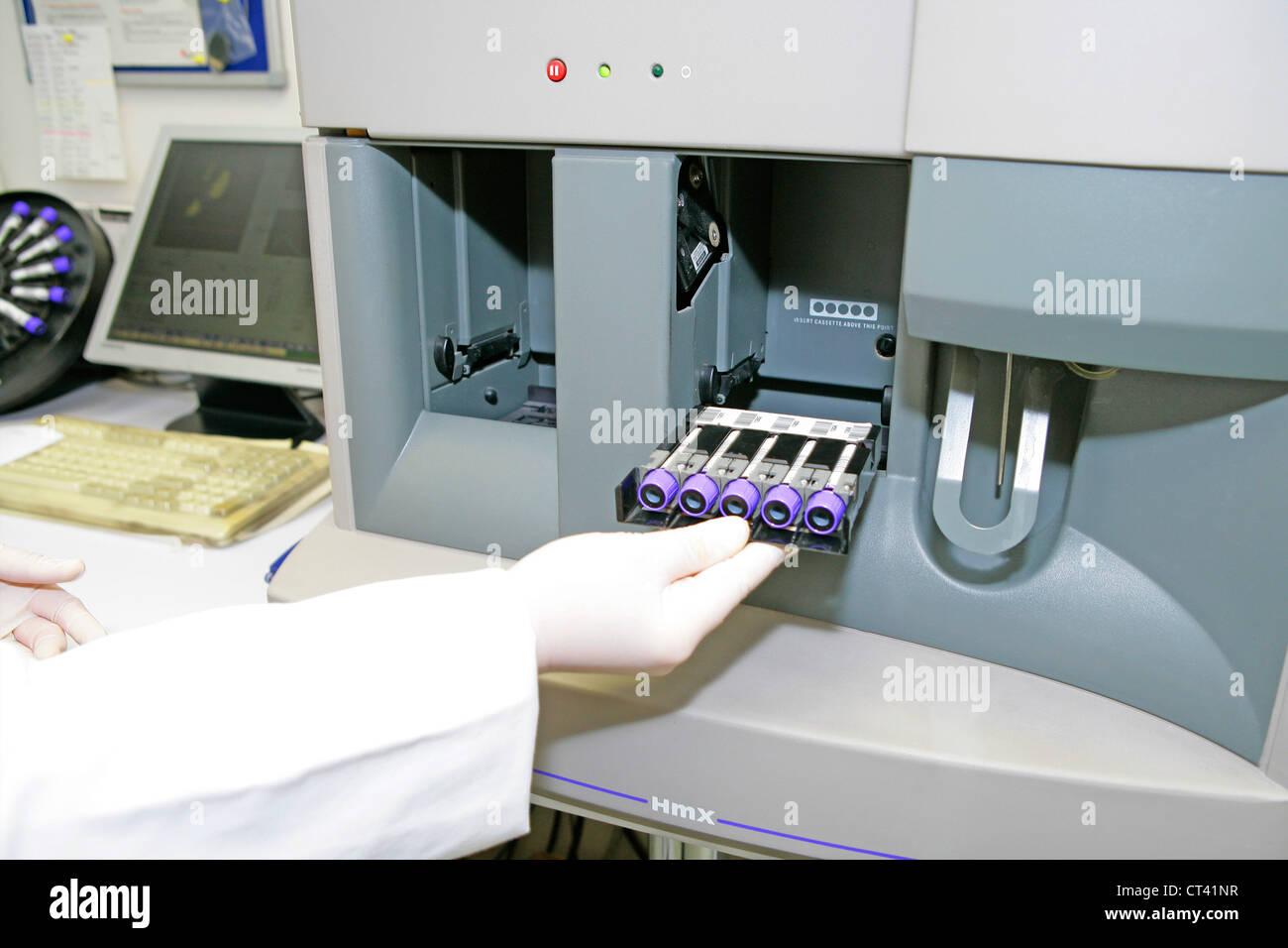 Hemogram hi-res stock photography and images - Alamy