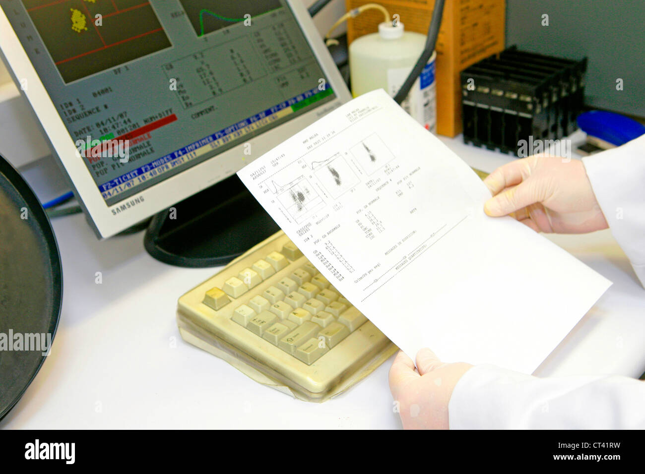 BLOOD ANALYSIS RESULT Stock Photo - Alamy