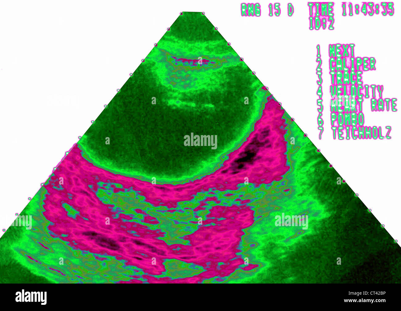 Uterus inspection hi-res stock photography and images - Alamy