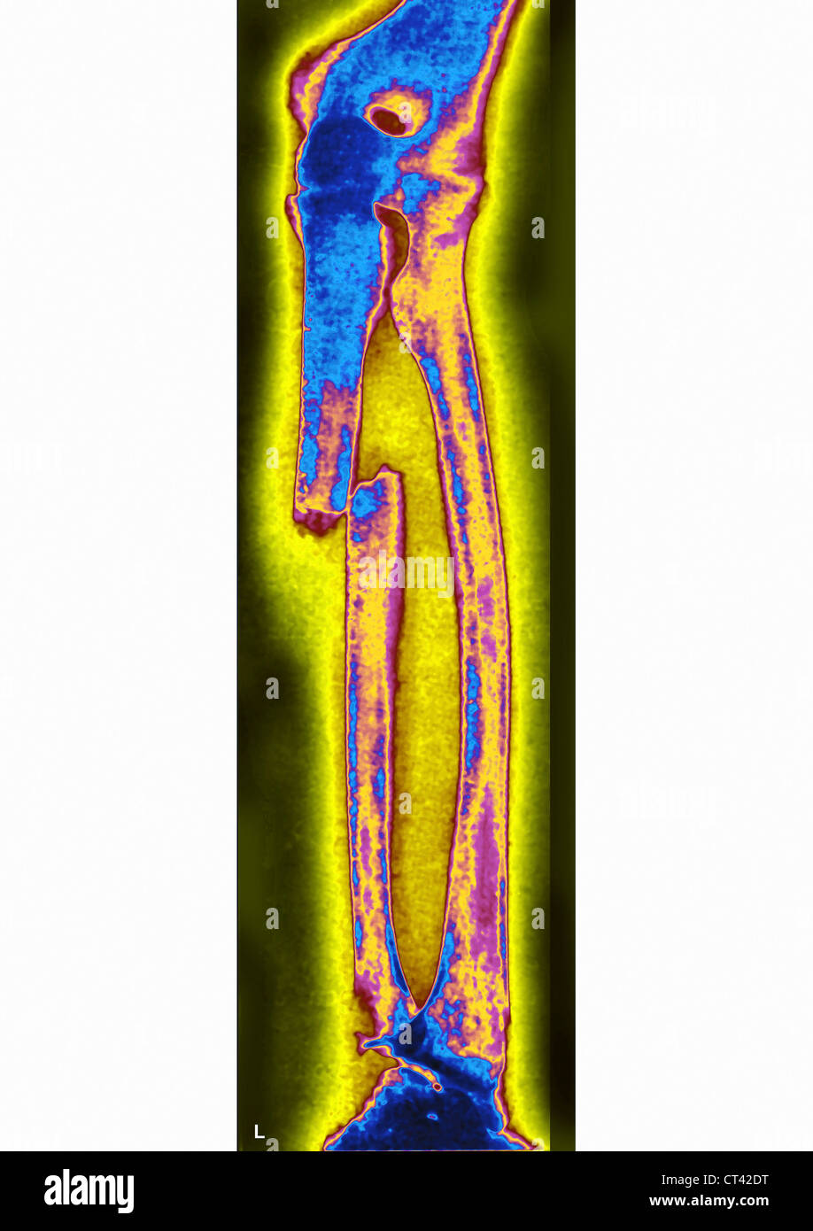 Forearm test hi-res stock photography and images - Alamy