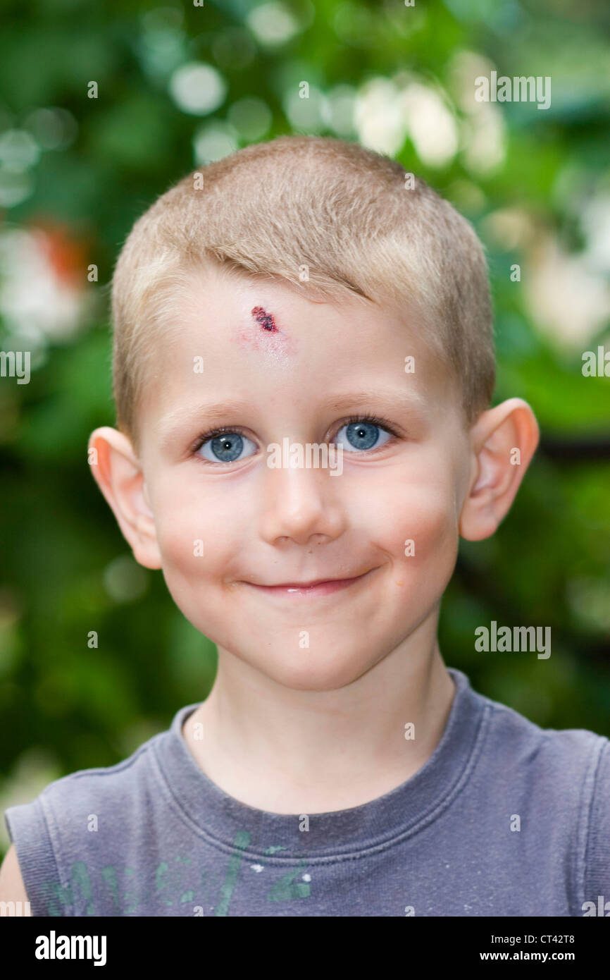 Accidental injury child hi-res stock photography and images - Alamy