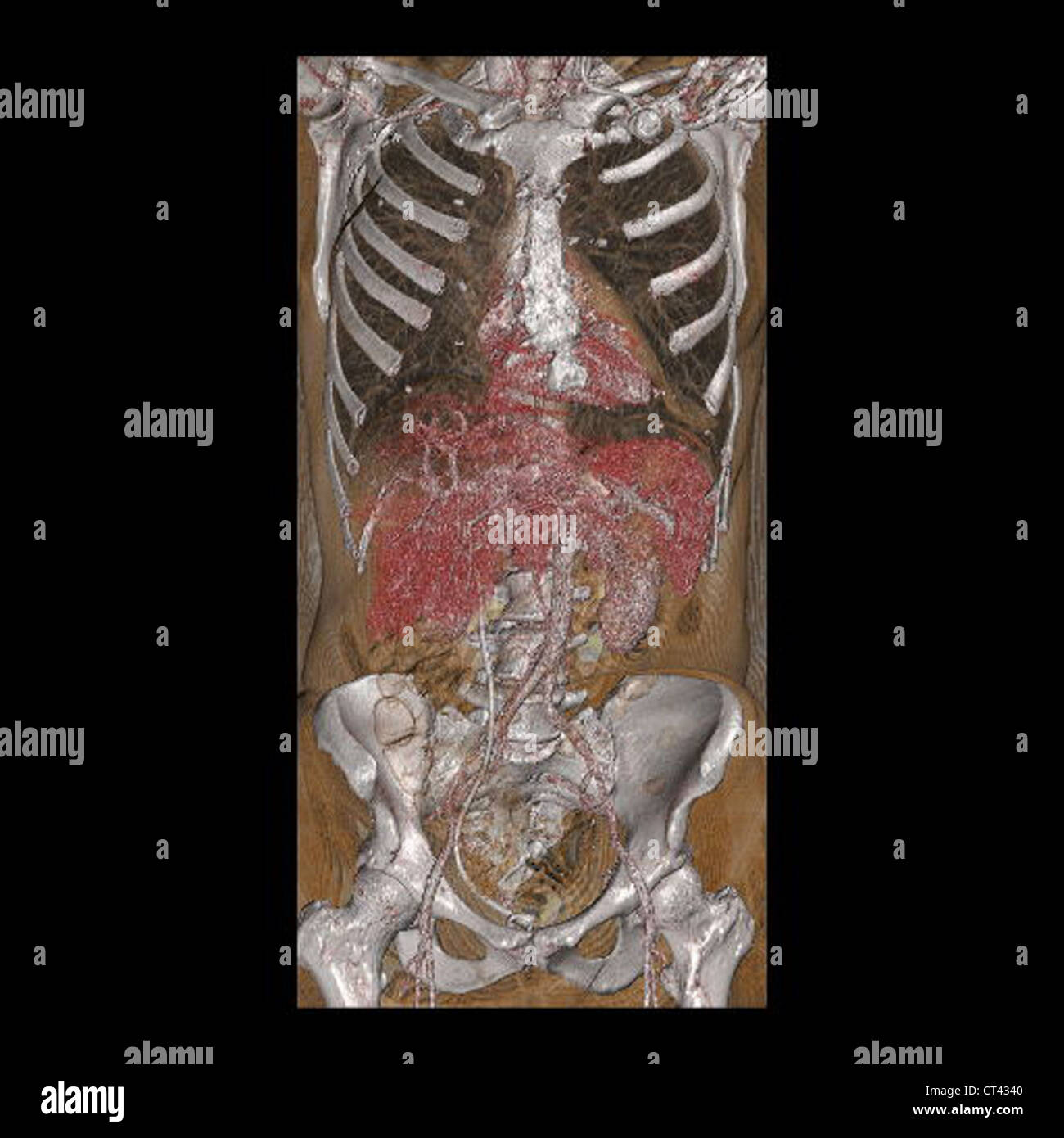 TRUNK, 3D SCAN Stock Photo - Alamy