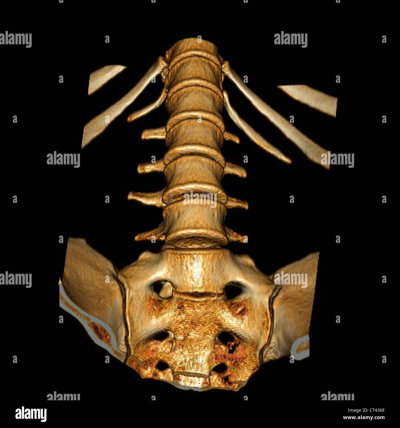 LUMBAR, 3D SCAN Stock Photo - Alamy