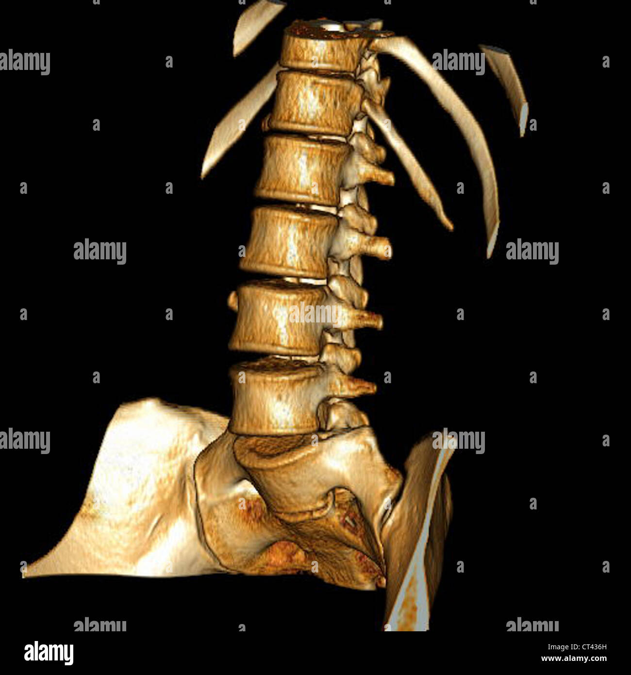 LUMBAR, 3D SCAN Stock Photo - Alamy