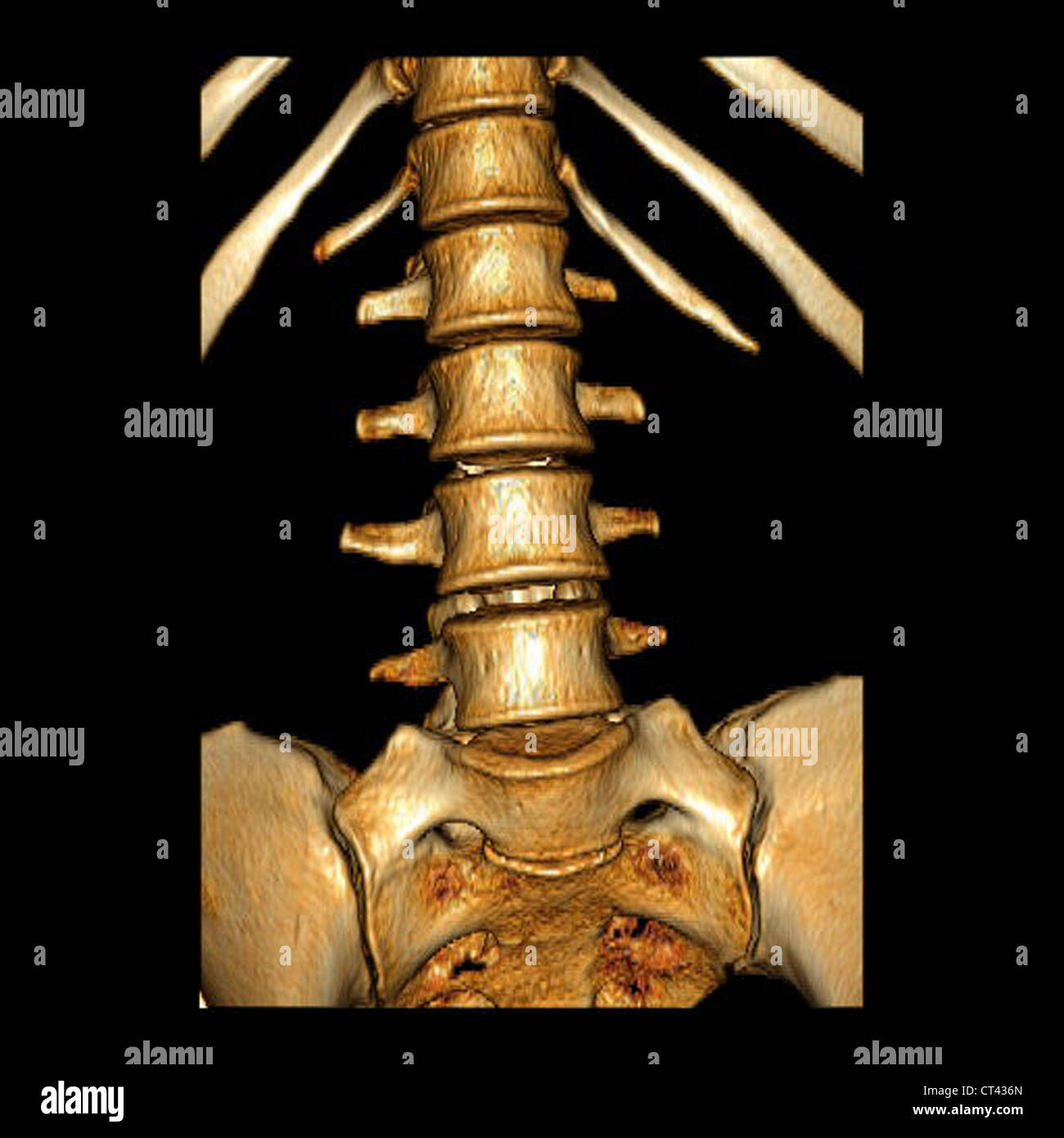 LUMBAR, 3D SCAN Stock Photo - Alamy