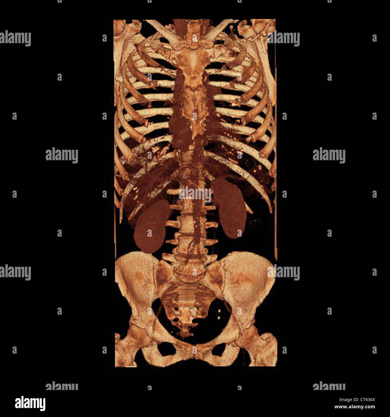 TRUNK, 3D SCAN Stock Photo - Alamy