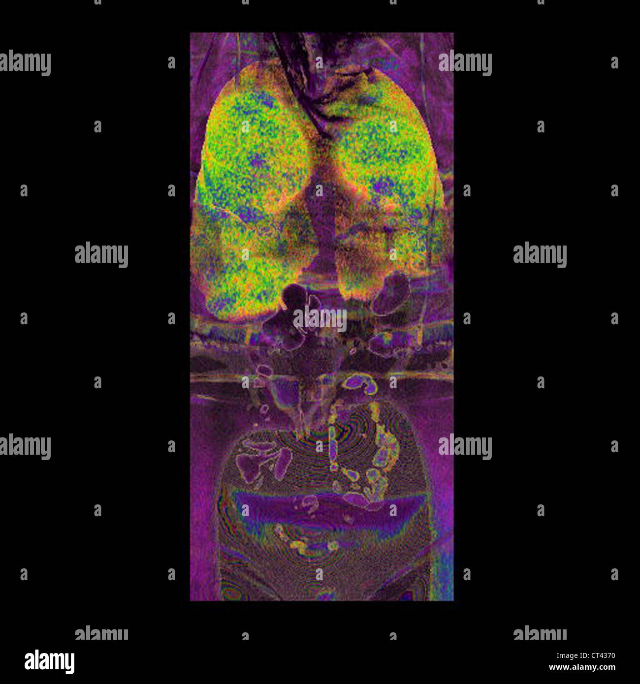 TRUNK, 3D SCAN Stock Photo - Alamy