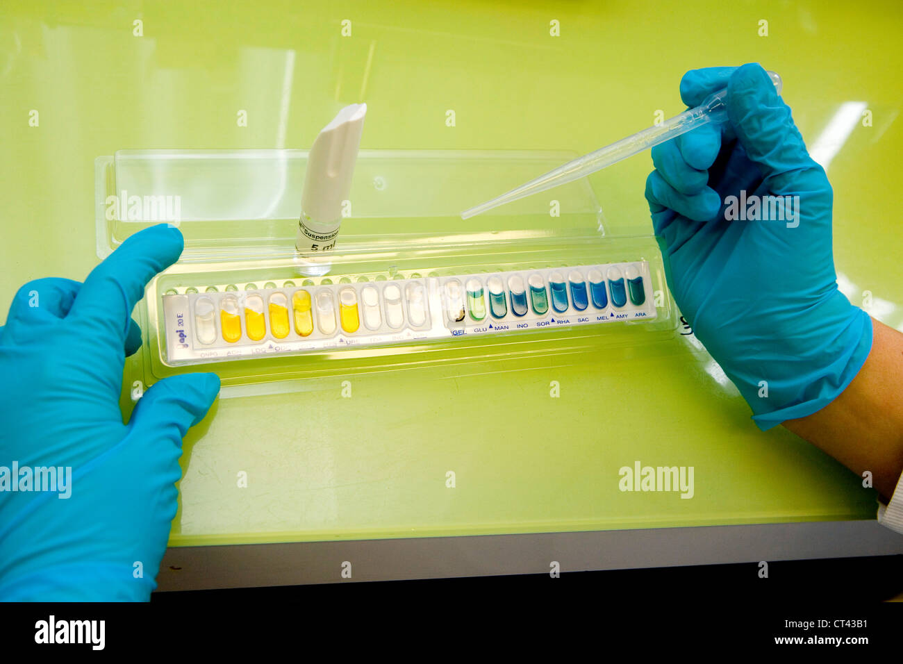 Bacterial identification hi-res stock photography and images - Alamy