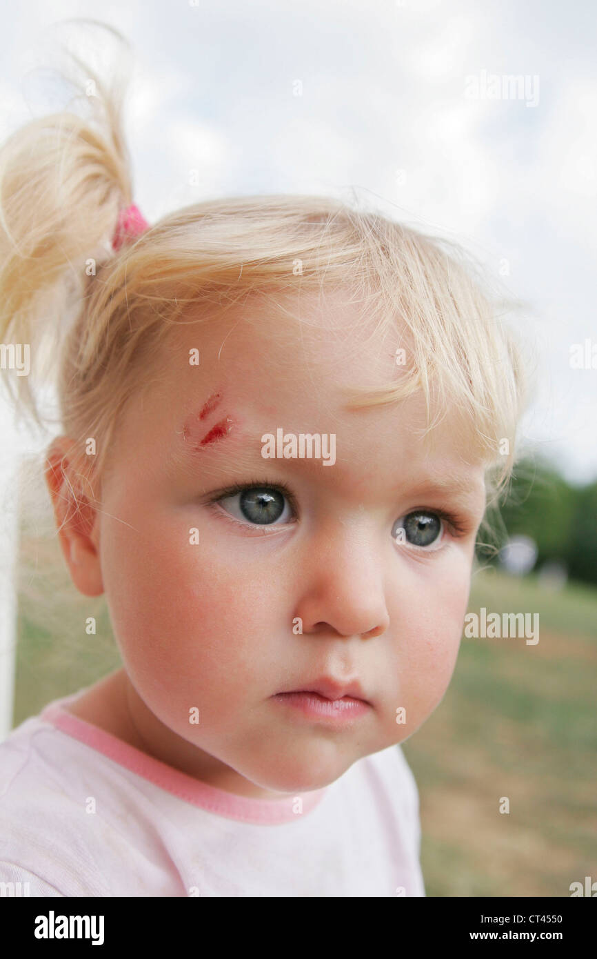 Sore sight hi-res stock photography and images - Alamy