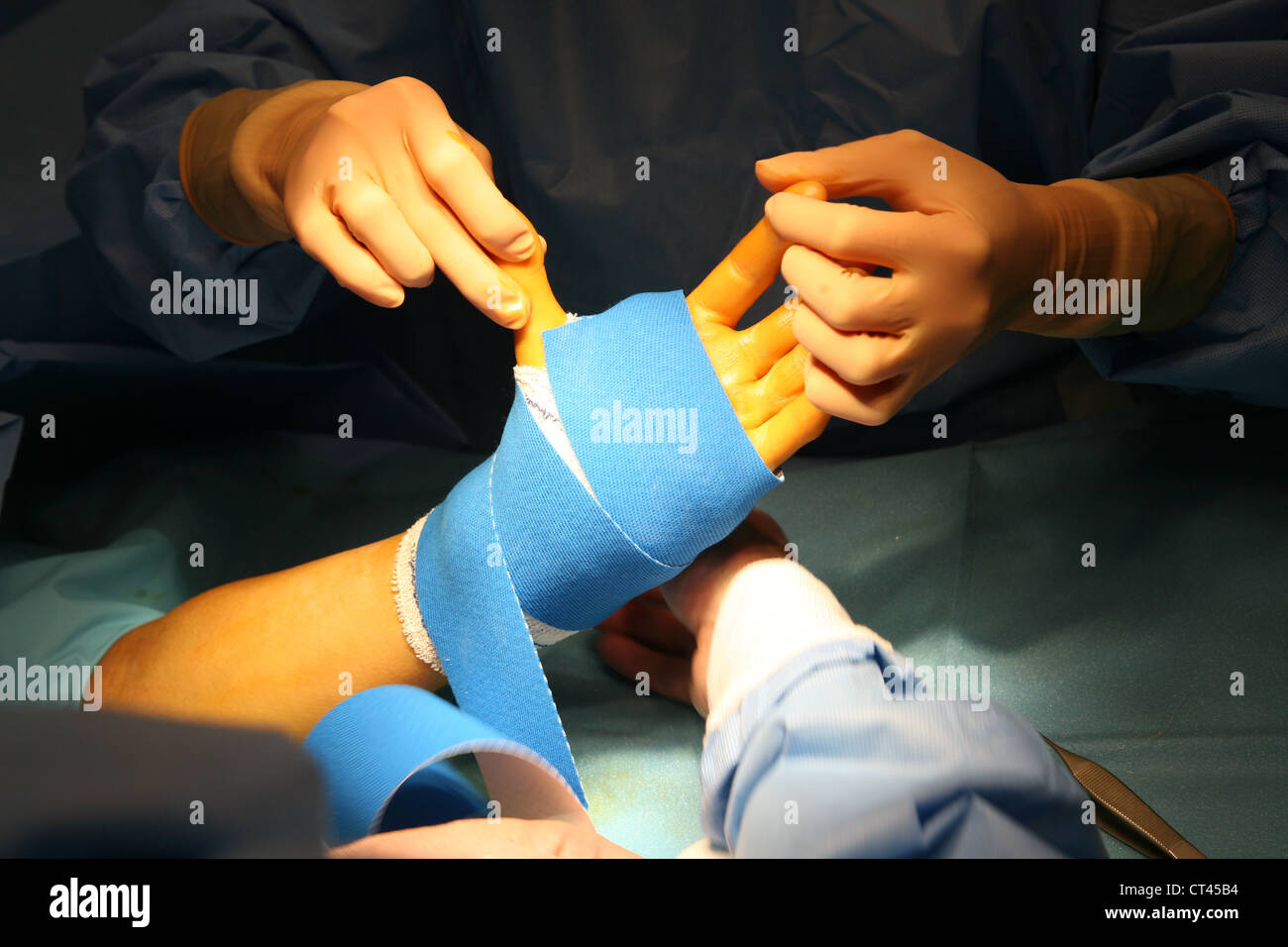 Hand and upper limb surgery hi-res stock photography and images - Alamy