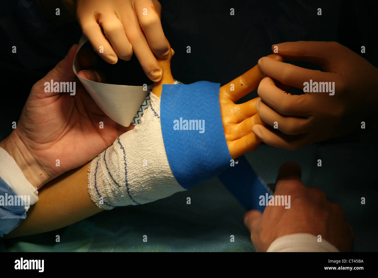 Hand and upper limb surgery hi-res stock photography and images - Alamy