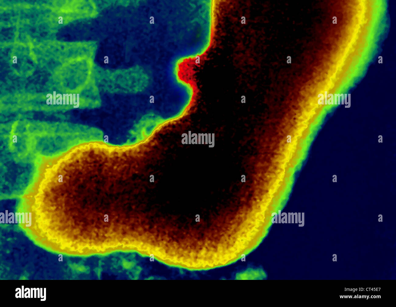 GASTRIC ULCER, X-RAY Stock Photo - Alamy