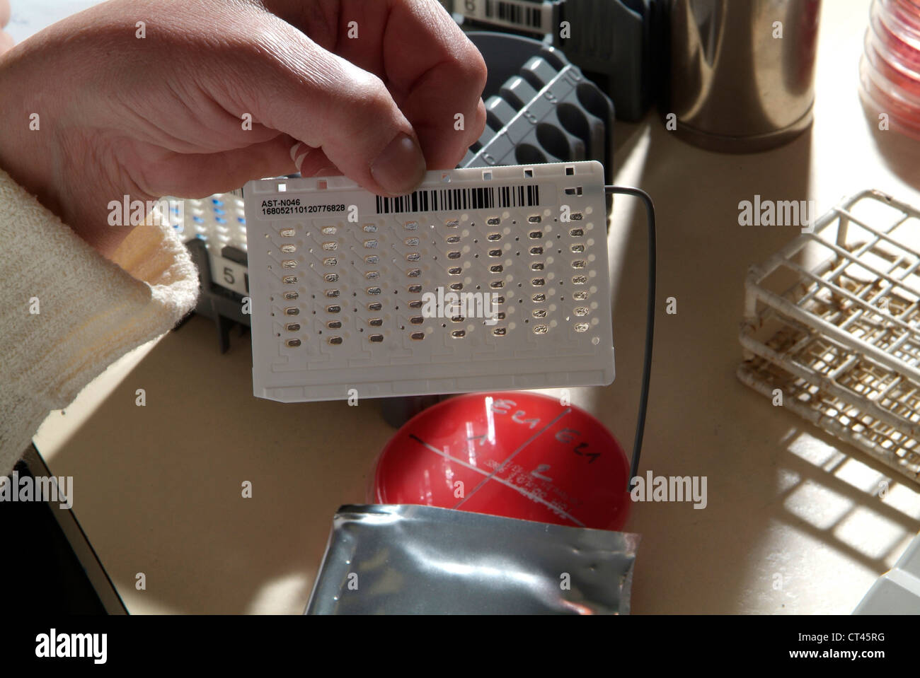 Vitek analysis hi-res stock photography and images - Alamy