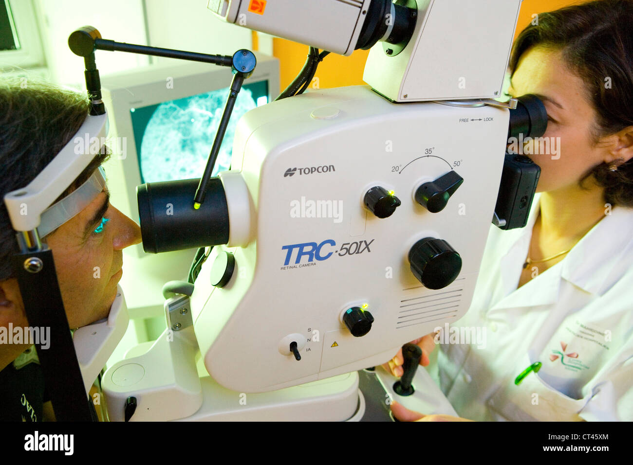 FLUORESCEIN ANGIOGRAM OF EYE Stock Photo - Alamy