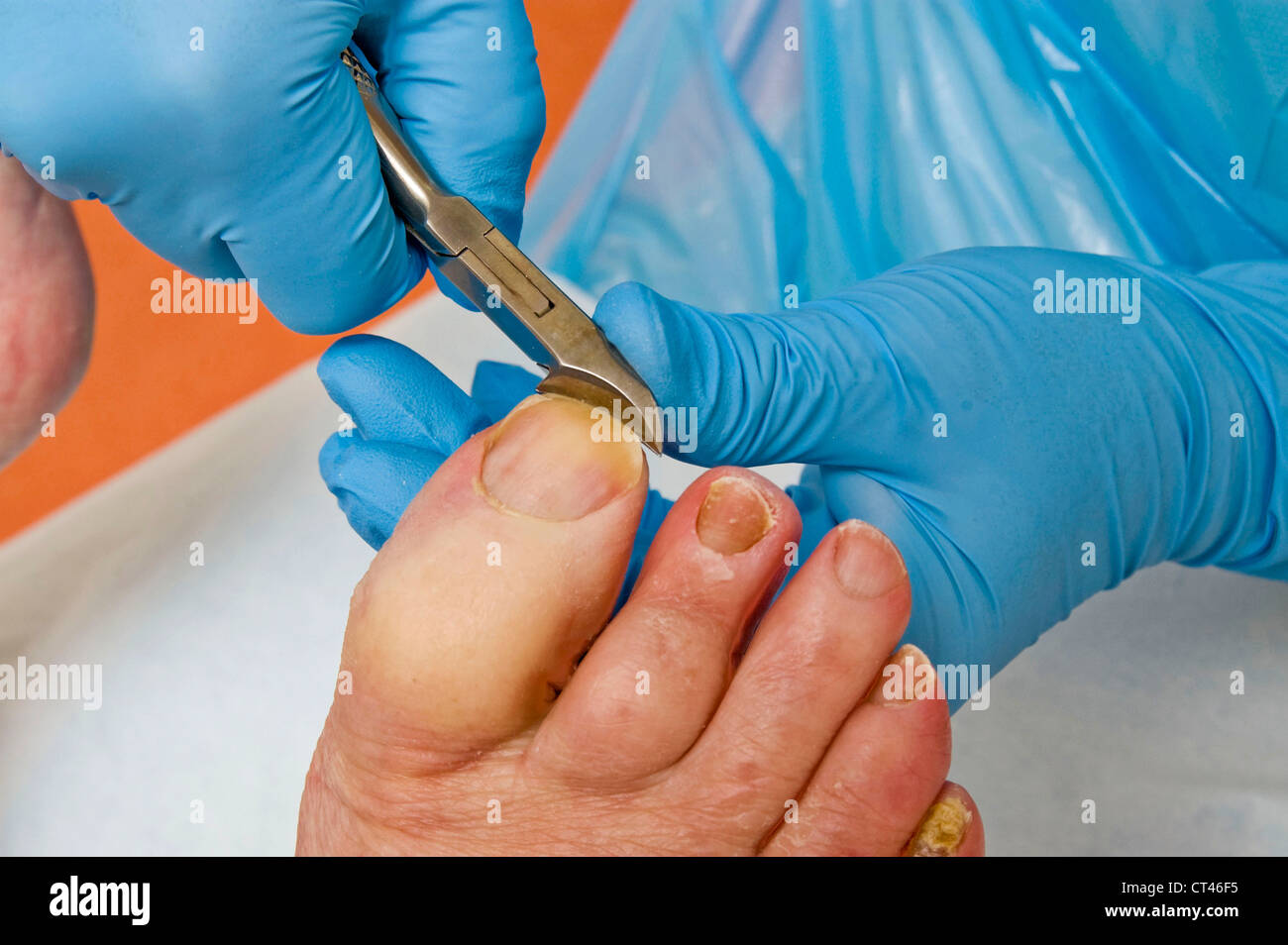 Cutting Toe Nails Stock Photos & Cutting Toe Nails Stock Images - Alamy