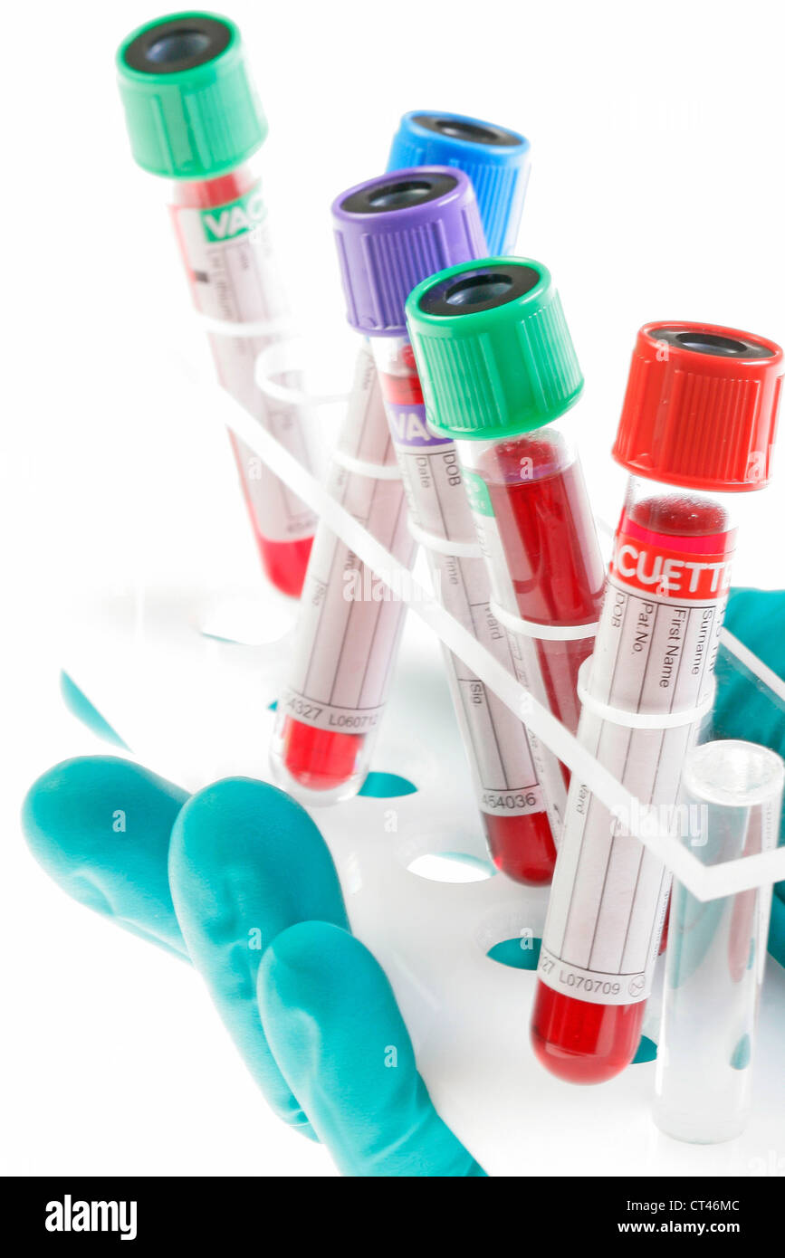 Test tubes holders hi-res stock photography and images - Alamy