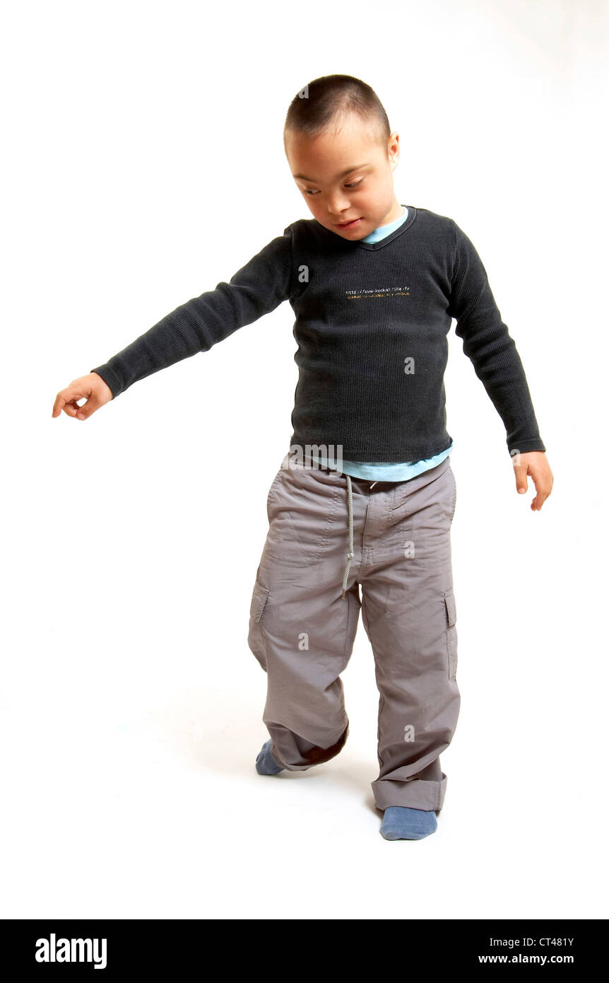 CHILD, DOWN'S SYNDROME Stock Photo - Alamy