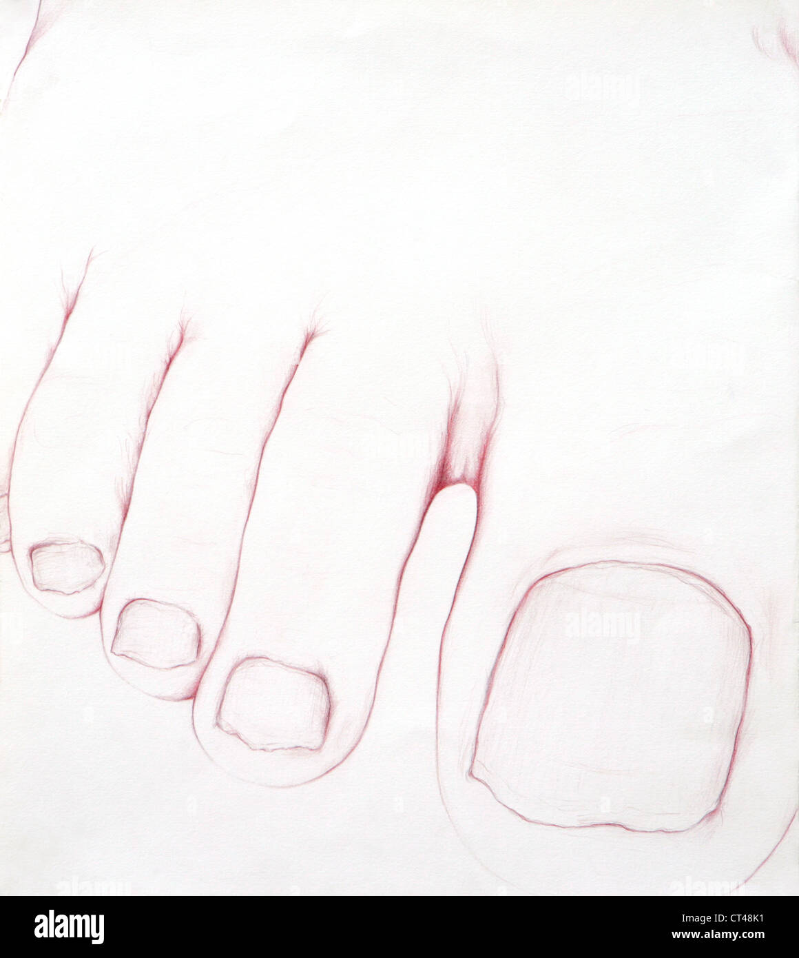 Toe without nail hi-res stock photography and images - Alamy