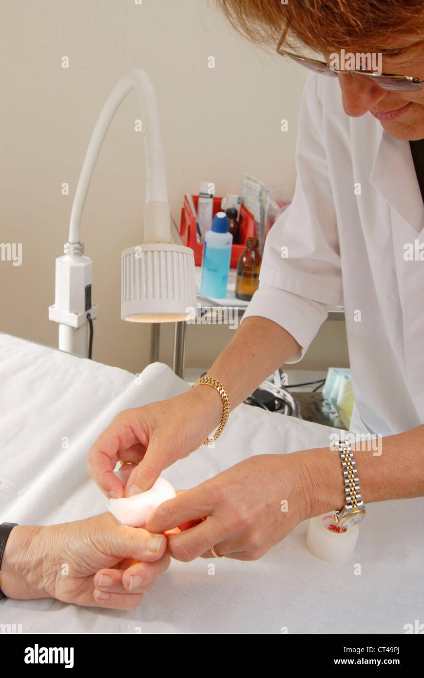 Cryotherapy verruca hi-res stock photography and images - Alamy