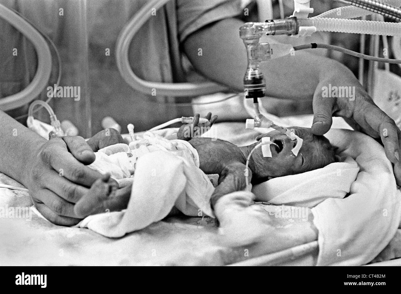PREMATURE BABY, CARE Stock Photo - Alamy