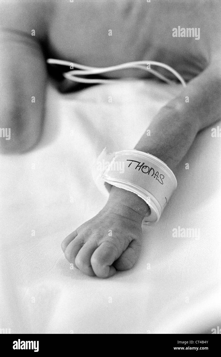 HAND OF PREMATURE BABY Stock Photo - Alamy