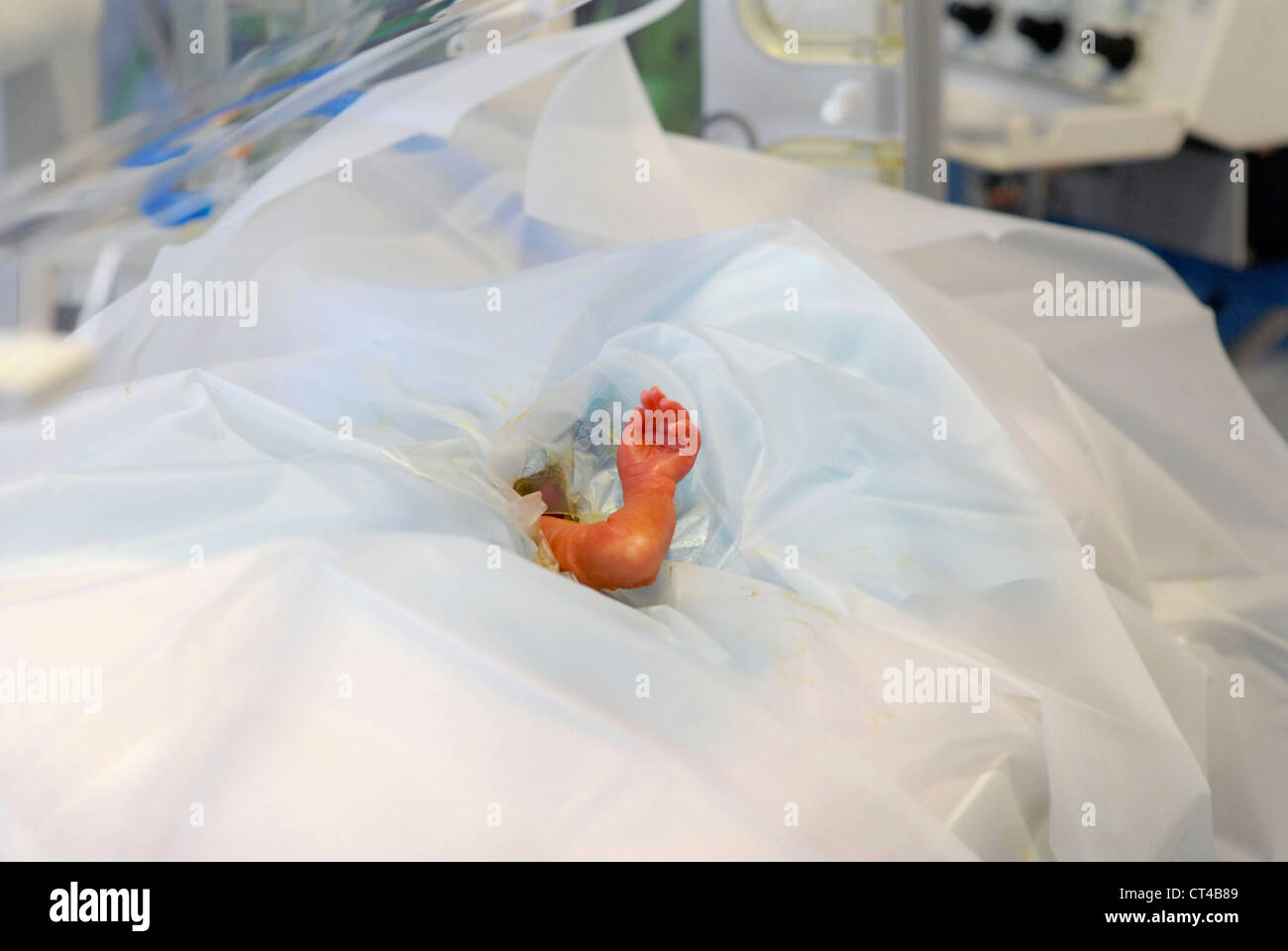 Child intensive care hand hi-res stock photography and images - Alamy