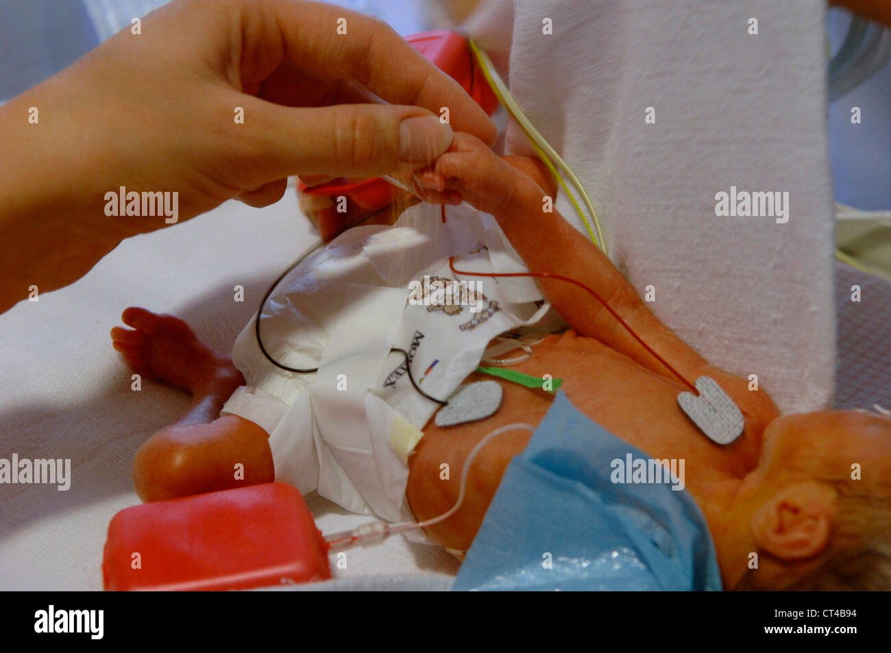 Electrode baby hi-res stock photography and images - Alamy