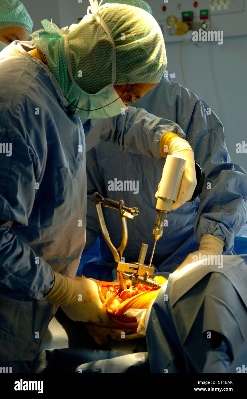 KNEE PROSTHESIS, SURGERY Stock Photo - Alamy