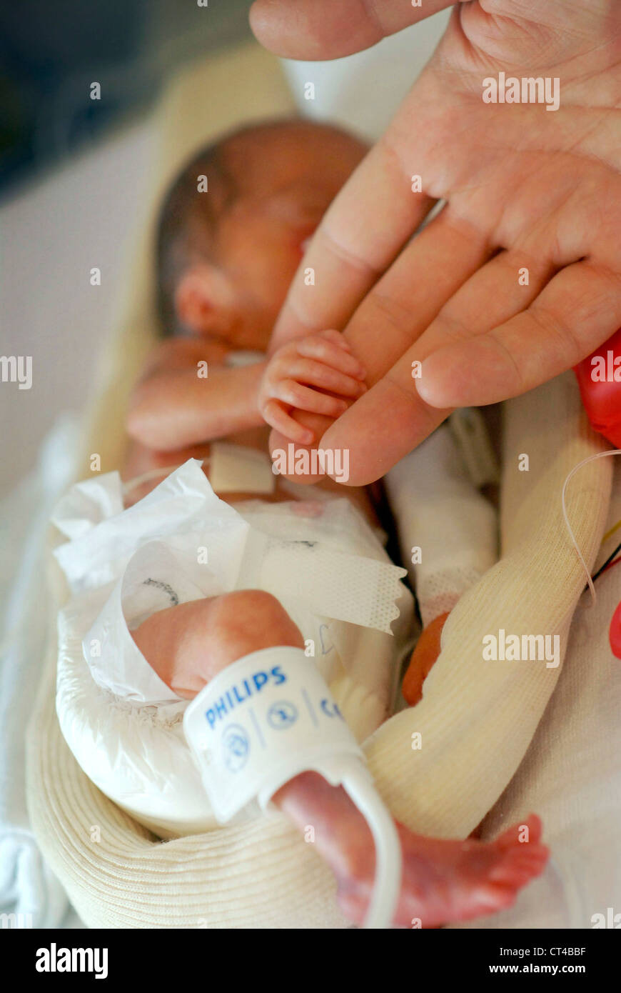 Premature Babies In Hands What To Expect When Your Premature Baby Is