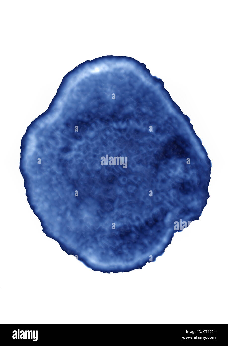 Glandular fever hi-res stock photography and images - Alamy