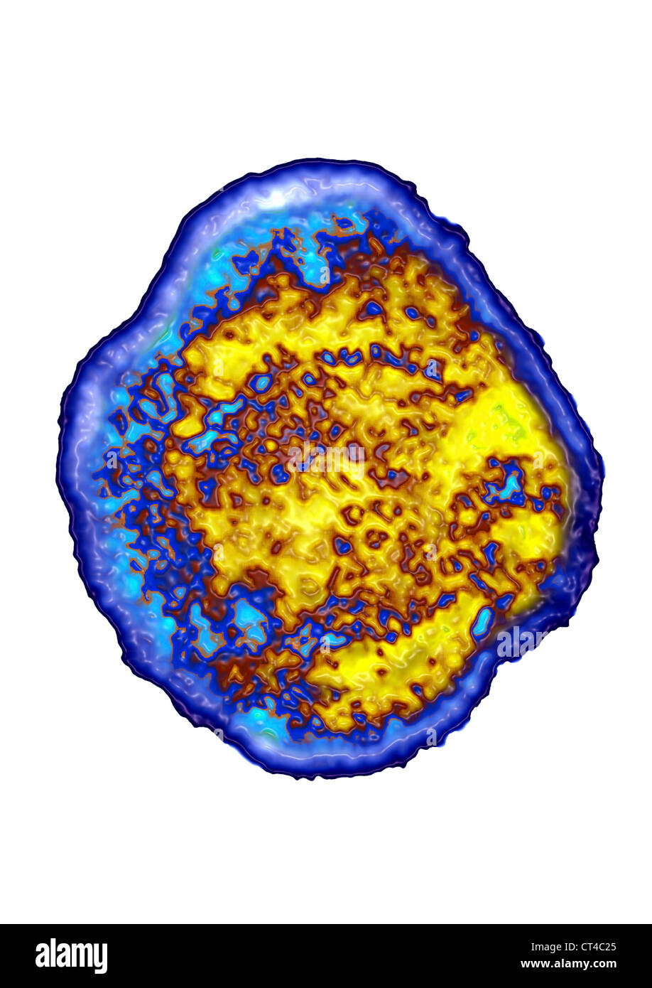 Glandular fever hi-res stock photography and images - Alamy