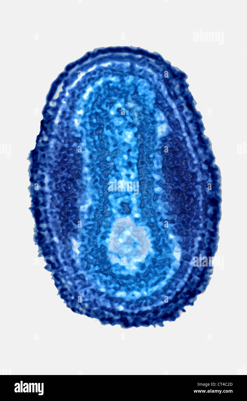 Poxviruses hi-res stock photography and images - Alamy