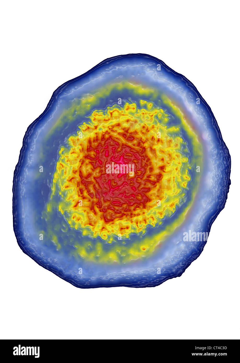 Electron microscope cytomegalovirus hi-res stock photography and images ...