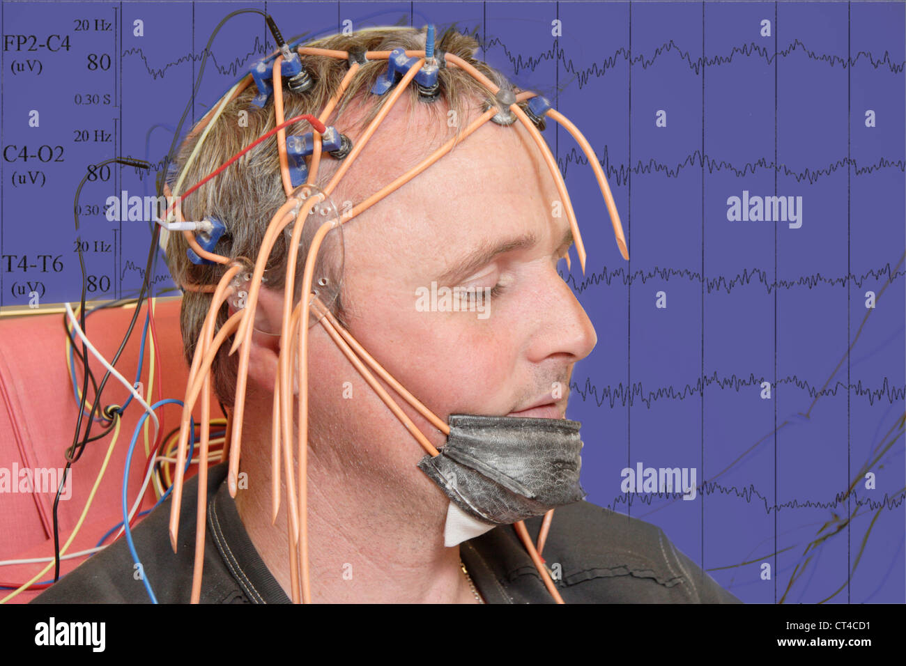 EEG EXAMINATION OF A MAN Stock Photo - Alamy