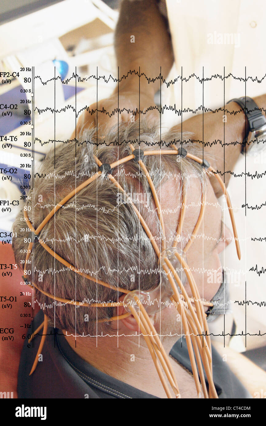 EEG EXAMINATION OF A MAN Stock Photo - Alamy