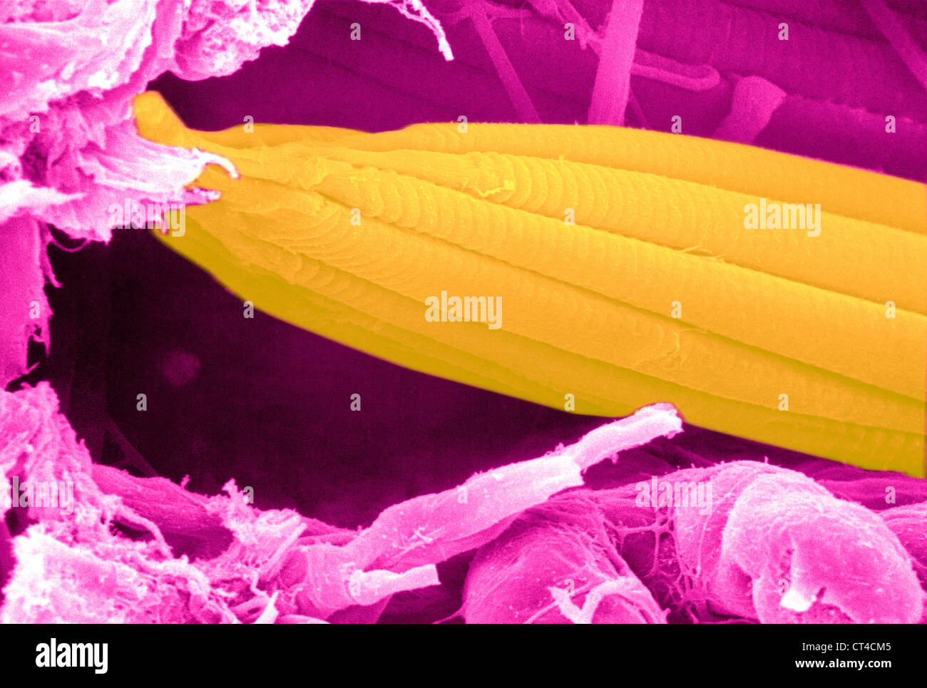 Skeletal muscle fibres sem hi-res stock photography and images - Alamy