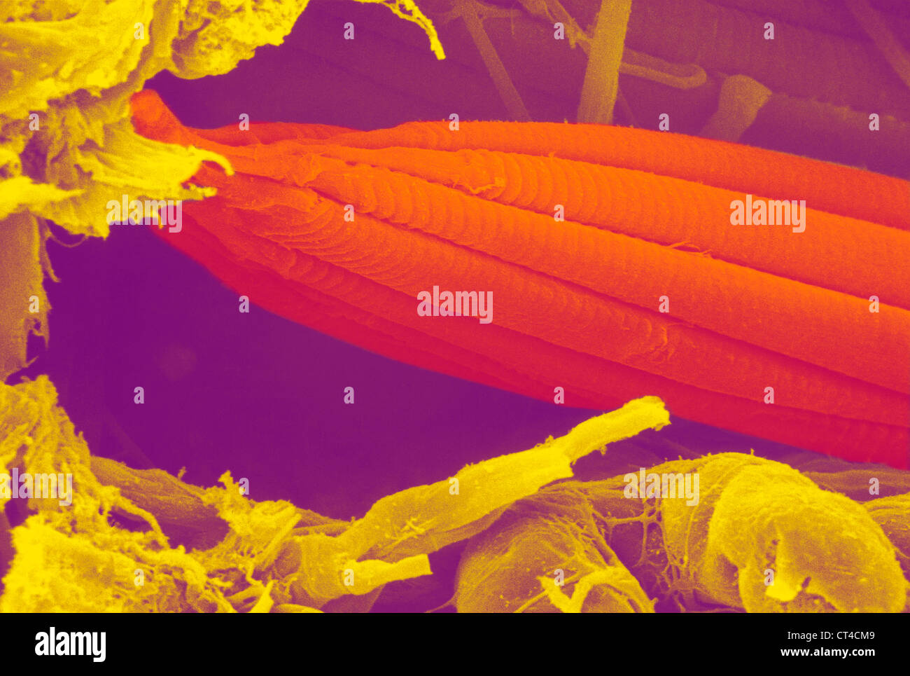 Skeletal muscle micrograph hi-res stock photography and images - Alamy