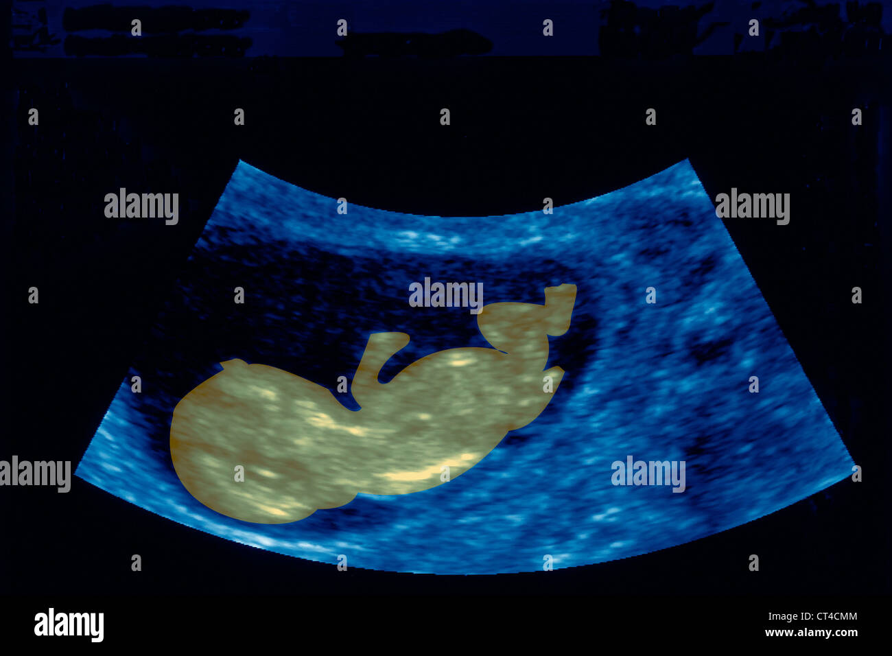 3 months fetus hi-res stock photography and images - Alamy
