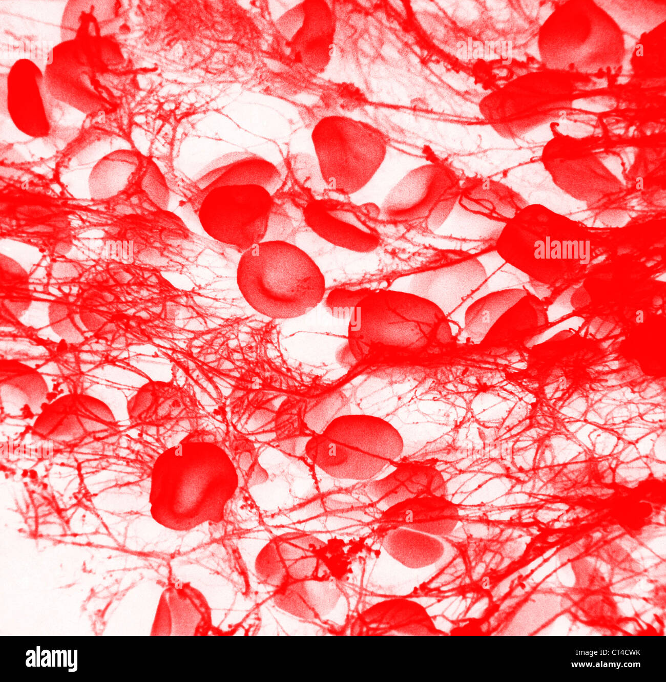 Red blood cells micrograph hi-res stock photography and images - Alamy