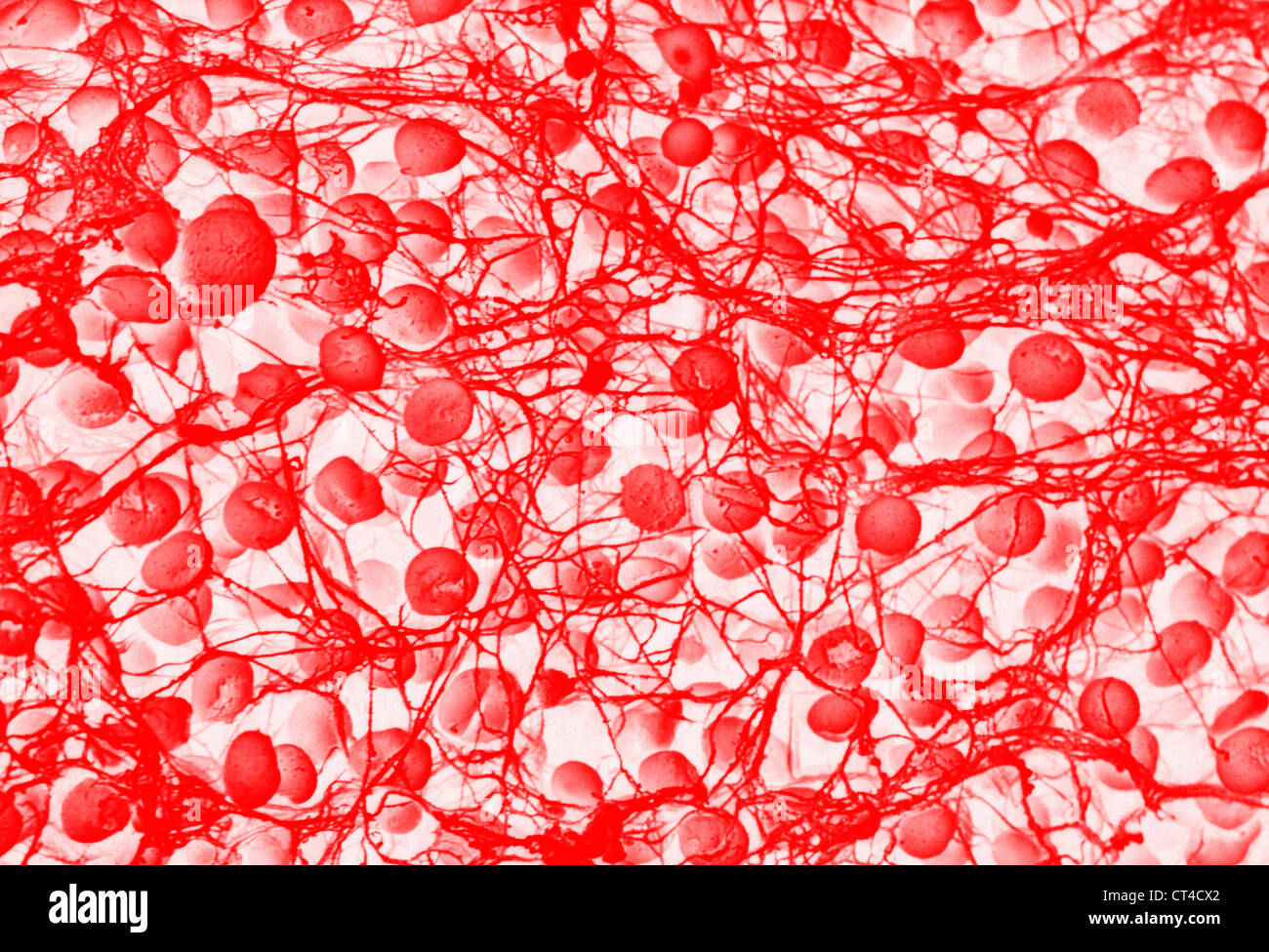 RED BLOOD CELL & FIBRIN, SEM Stock Photo - Alamy