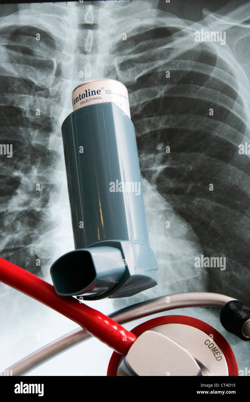 Salbutamol inhalers hi-res stock photography and images - Alamy