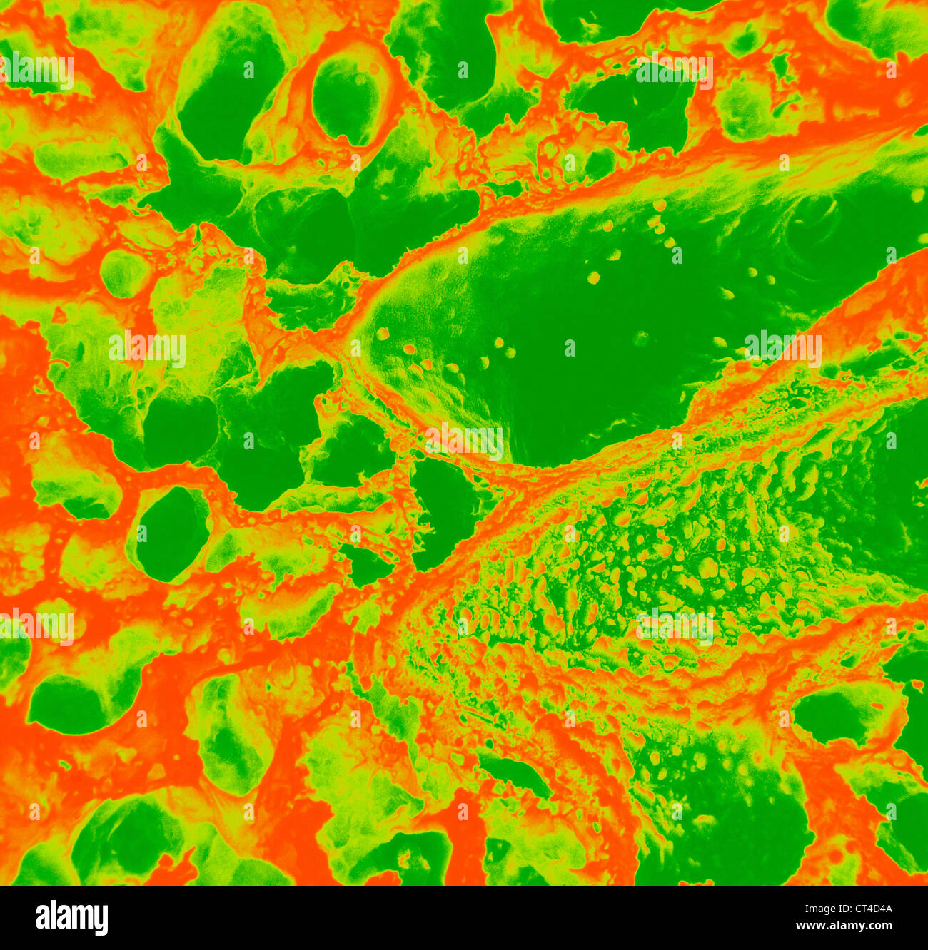 Lung alveolus micrograph hi-res stock photography and images - Alamy
