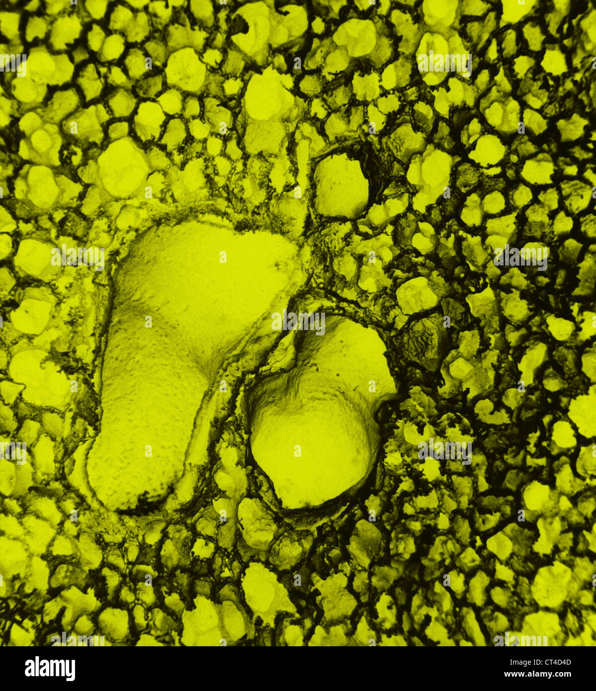 Lung alveolus micrograph hi-res stock photography and images - Alamy