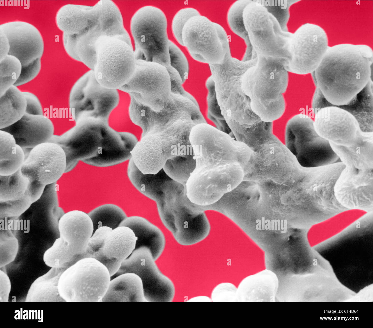 Micrograph lung alveoli alveolar hi-res stock photography and images ...
