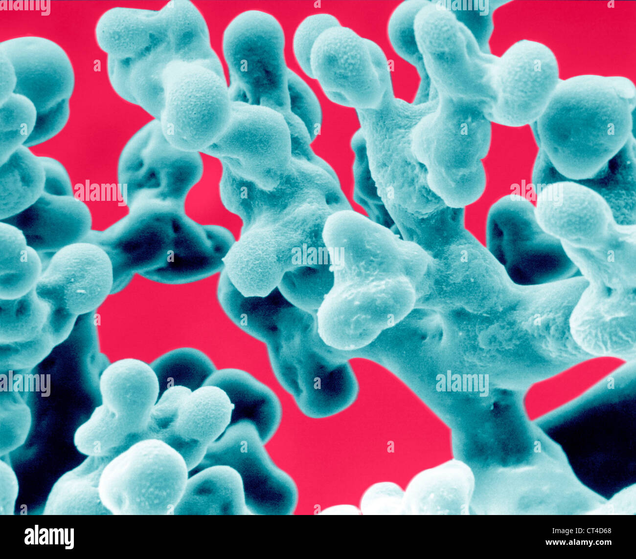 LUNG ALVEOLUS, SEM Stock Photo - Alamy