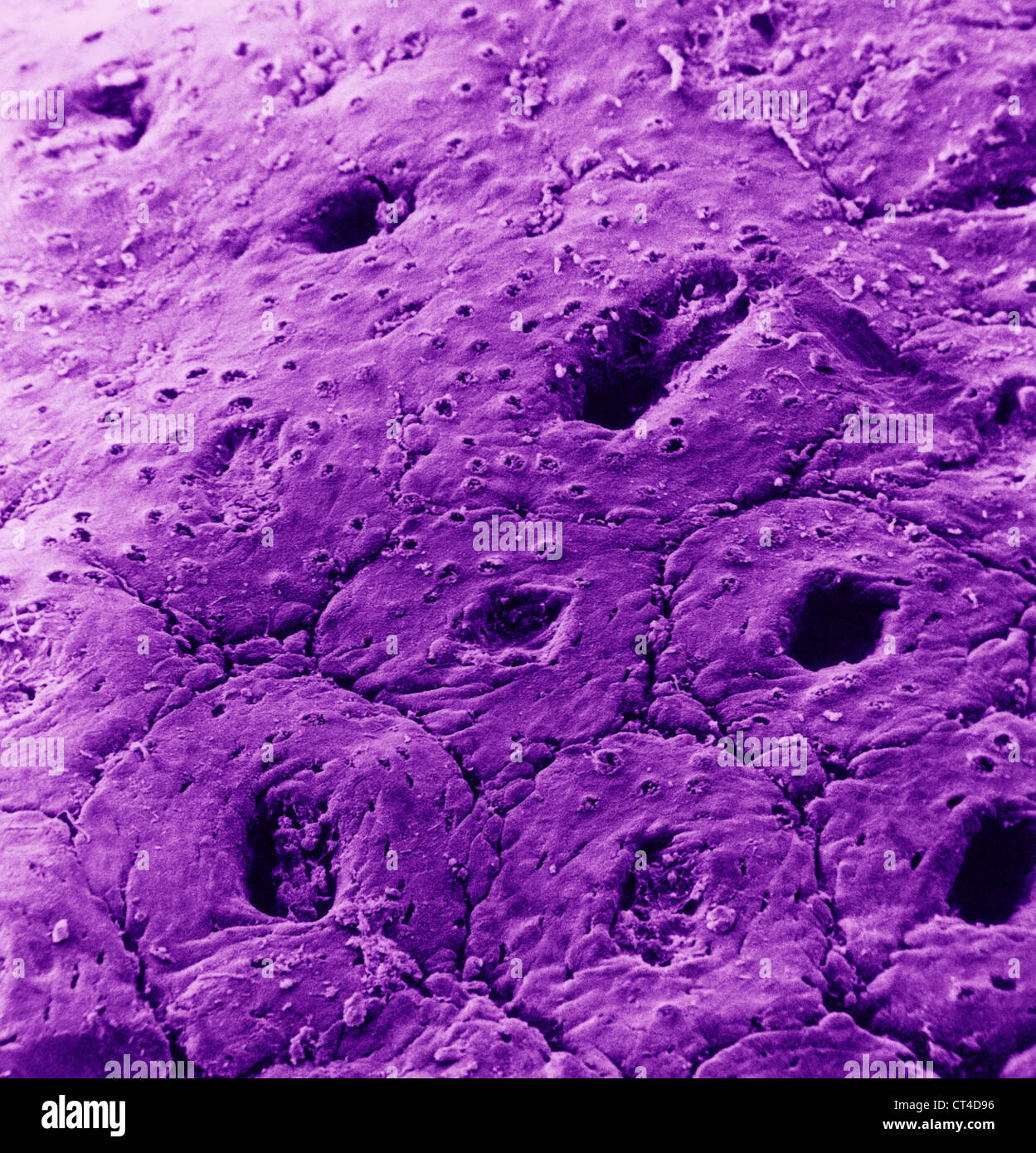 Mucosa High Resolution Stock Photography and Images - Alamy